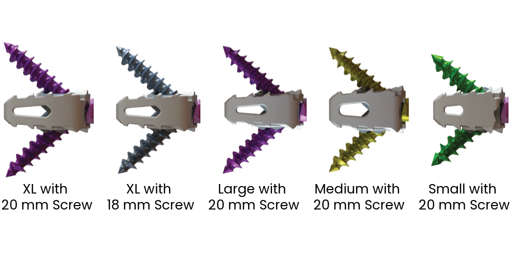 SureMAX-SA – Additive Implants